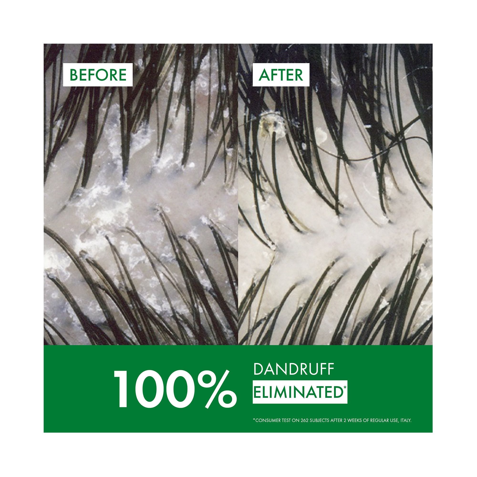 Buy Vichy Dercos Shampoo Dandruff Dry 200 Ml Online in UAE | Al Ain ...